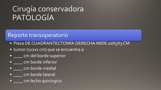 Cáncer de mama / Estadios y cirugía conservadora | PPSX