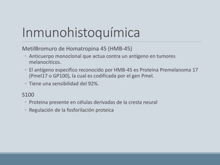 Cáncer de ojo | PPTX