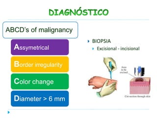 Cáncer de piel | PPT