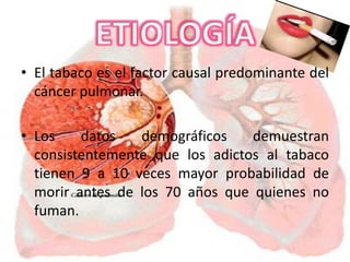 Cáncer de pulmón | PPTX