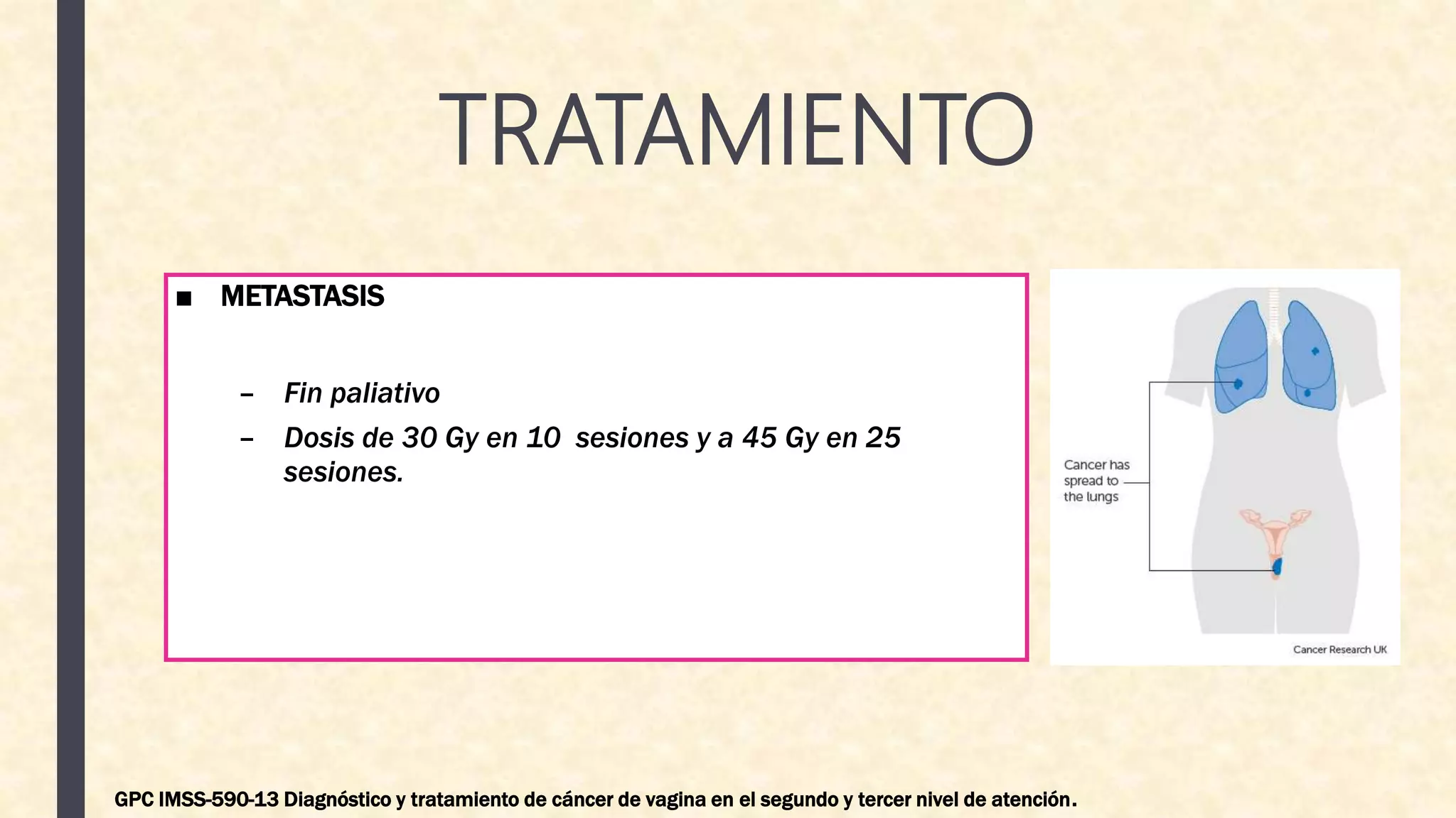 Cáncer Invasor De Vagina Pptx