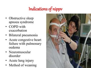 overview of mechanical ventilation and nursing care | PPTX