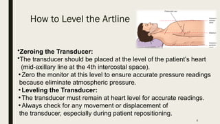 CNE Artline System in ICU. Care of arterial line in ICU and what need ...
