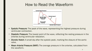CNE Artline System in ICU. Care of arterial line in ICU and what need ...