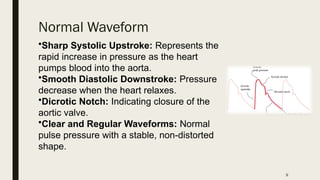 CNE Artline System in ICU. Care of arterial line in ICU and what need ...