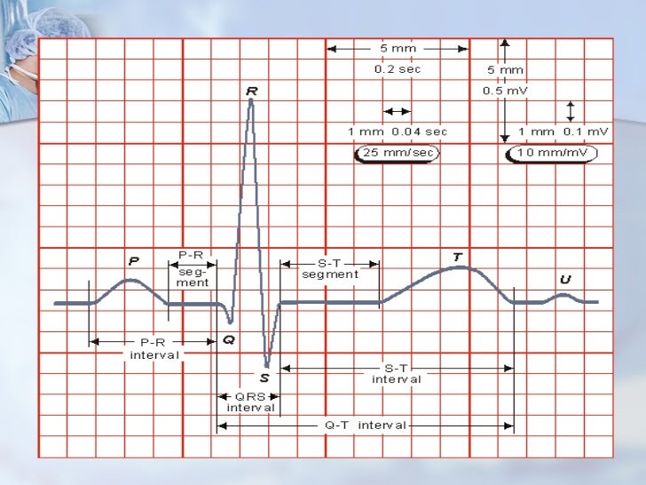 BASIC ECG