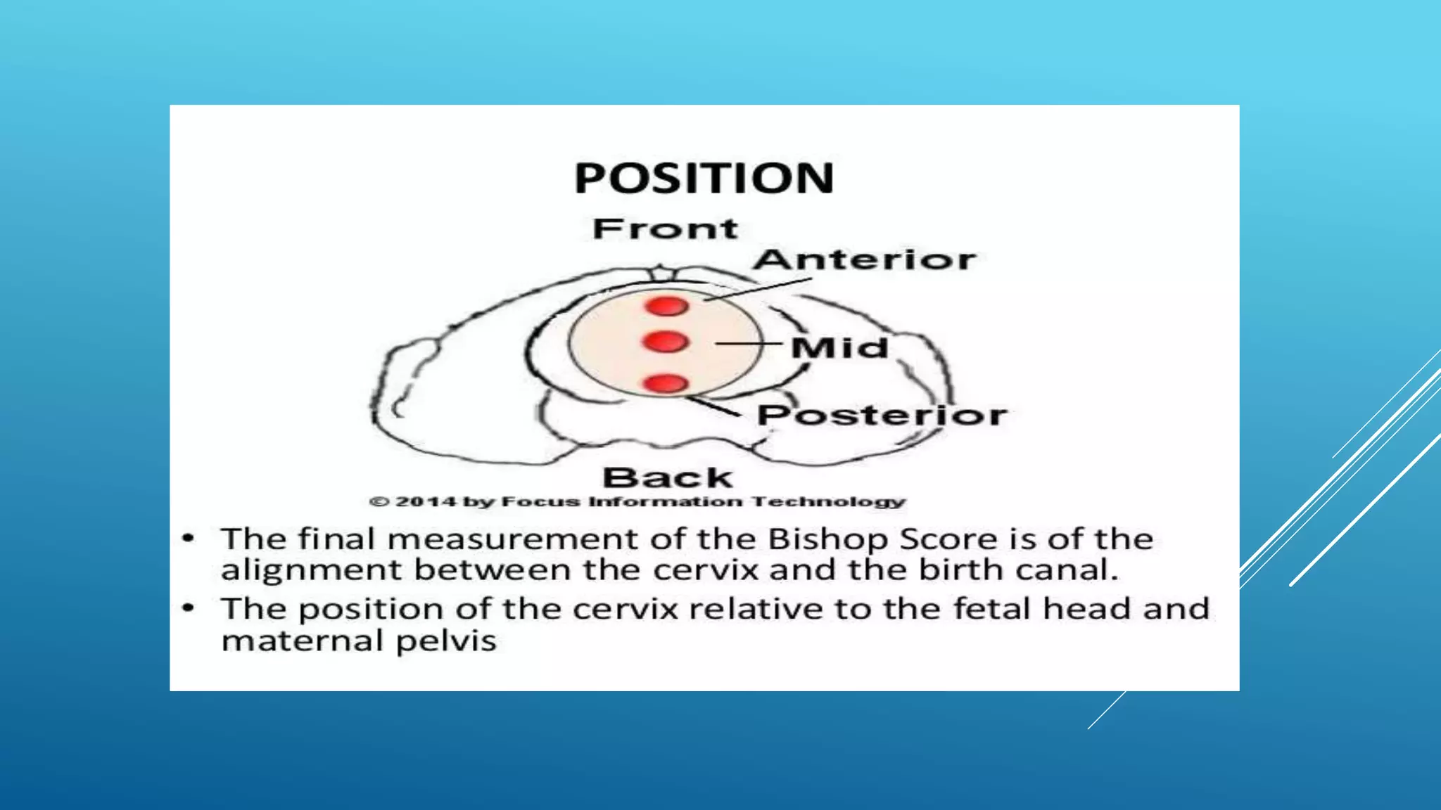 Cne on bishop’s score | PPTX