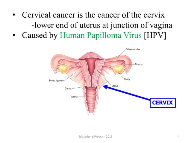 CNE PRESENTATION.pptx