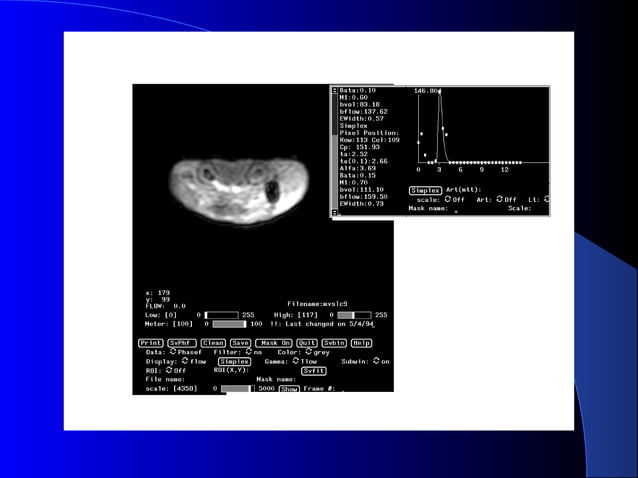 044 mice mri | PPT