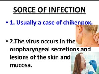 Chickenpox | PPTX