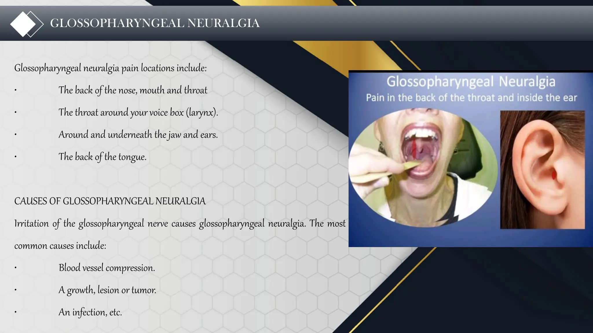 Glossopharyngeal Nerve: Anatomy, Function & Clinical Significance. IX ...