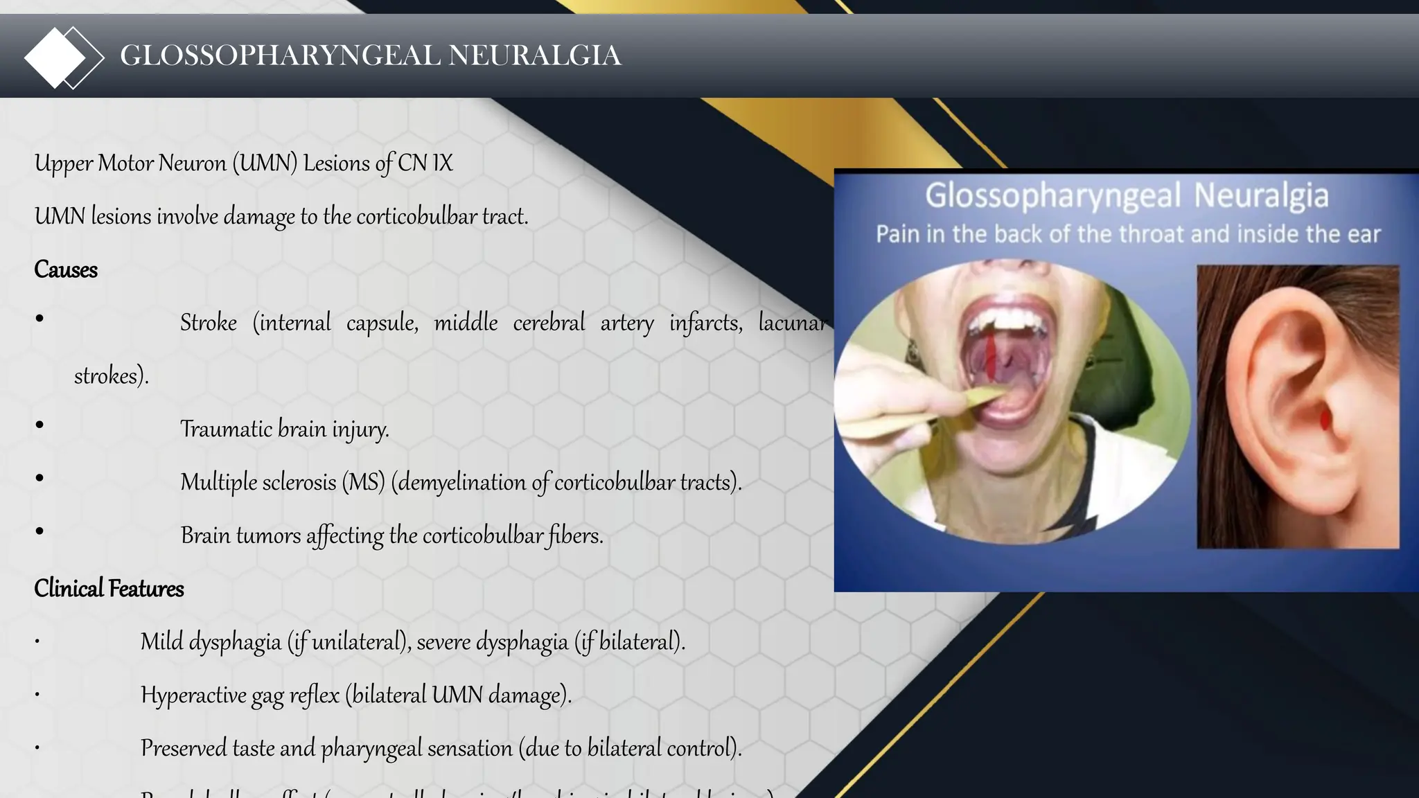 Glossopharyngeal Nerve: Anatomy, Function & Clinical Significance. IX ...