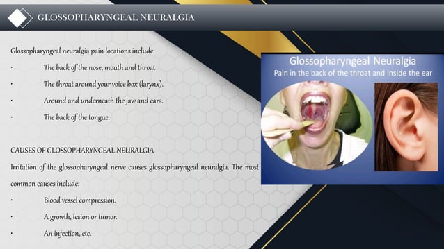 Glossopharyngeal Nerve: Anatomy, Function & Clinical Significance. IX ...
