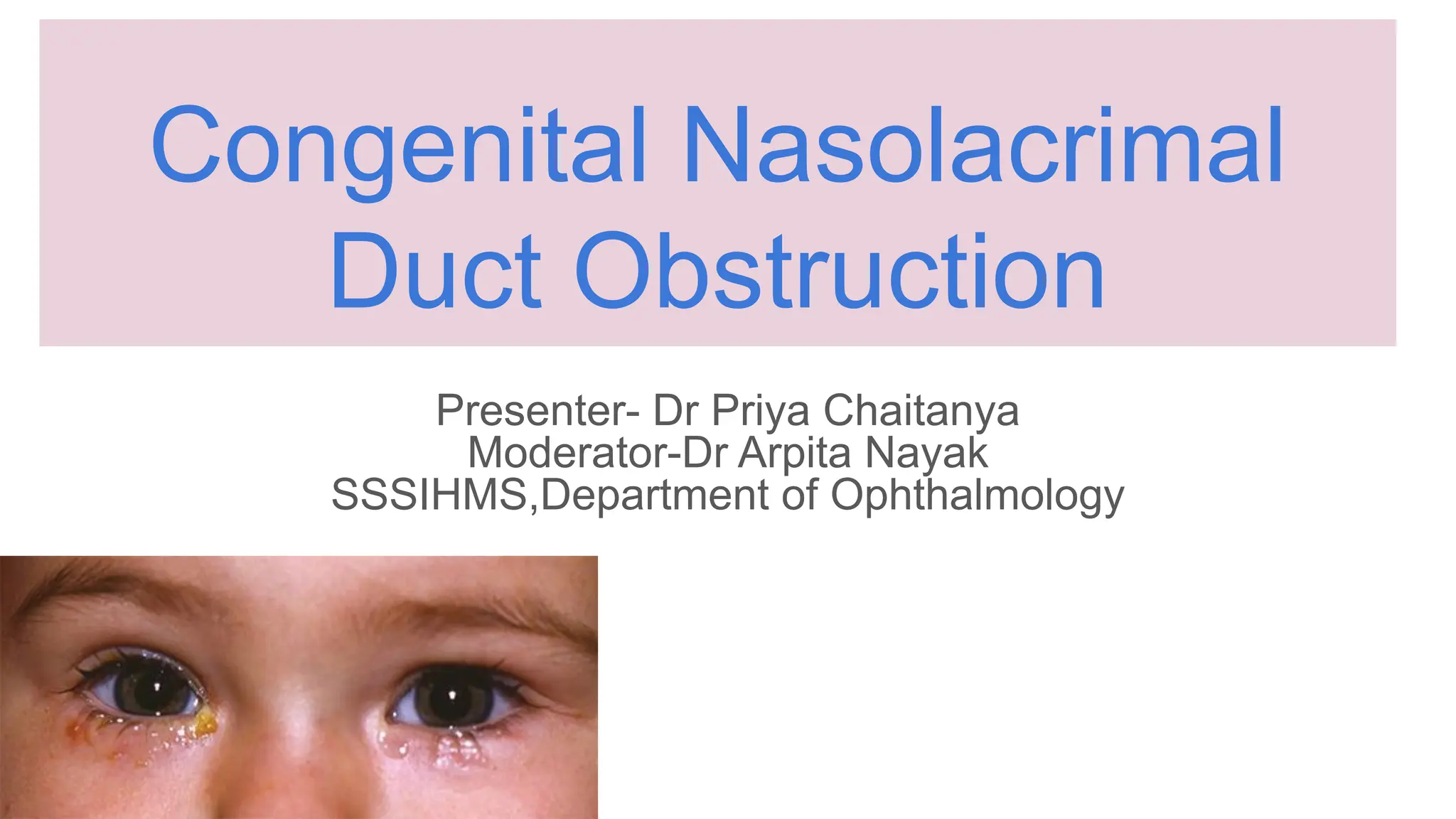 CNLDO-congenital Nasolacrimal Duct obstruction | PDF