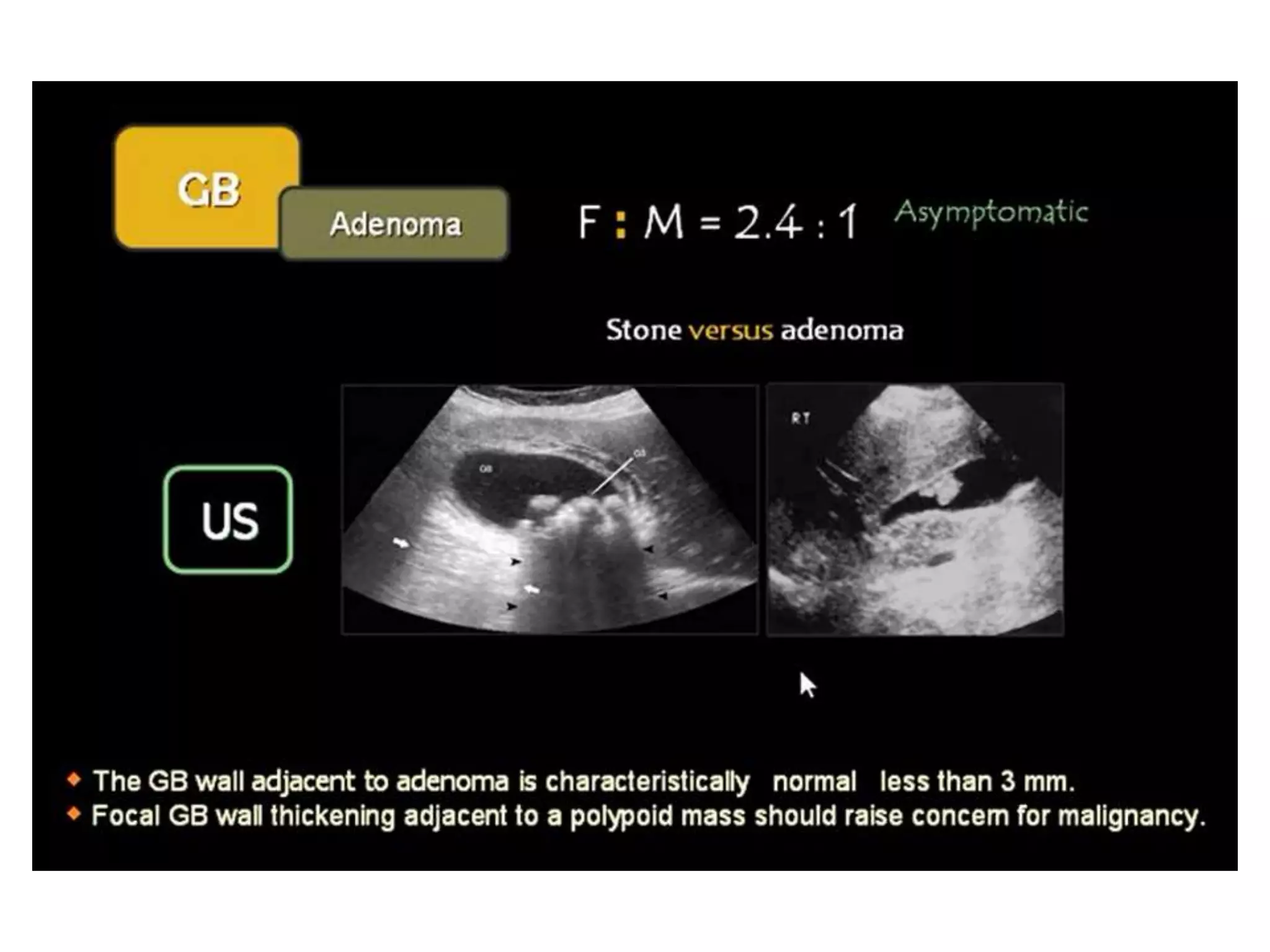 Biliary system | PPTX