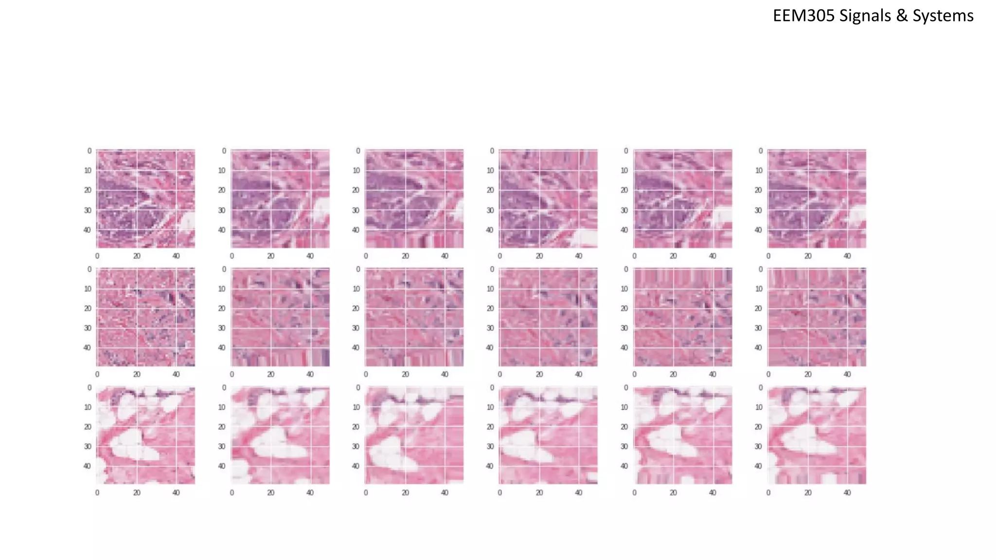 Breast Cancer Detection With Convolutional Neural Networks Cnn Pptx