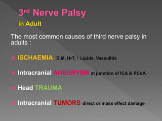 Cranial Nerve 3 Palsy