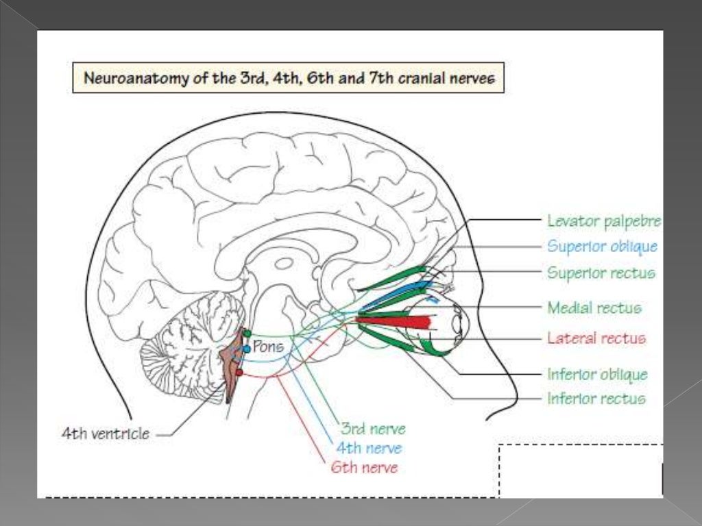 3rd, 4th, & 6th cranial nerve palsy