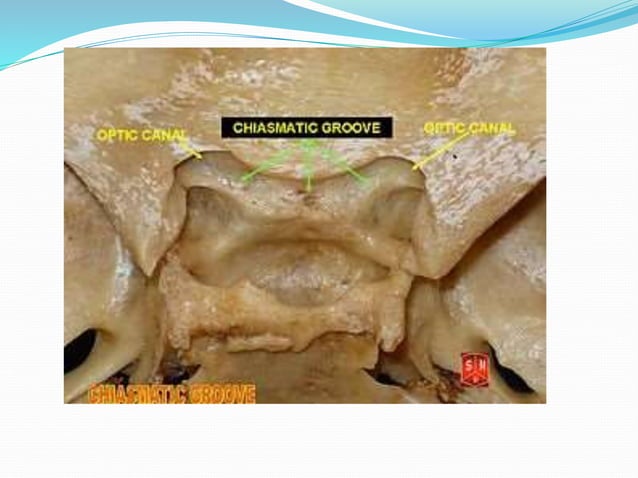 the cranial nerves | PPTX | Death, Injury, or Military Conflict ...