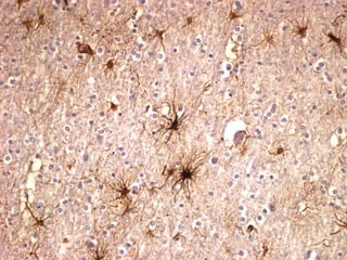 CENTRAL NERVOUS SYSTEM PATHOGENESIS AND PATHOLOGY | PPTX