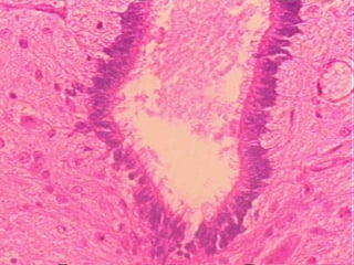 CENTRAL NERVOUS SYSTEM PATHOGENESIS AND PATHOLOGY | PPTX