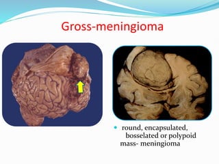 CENTRAL NERVOUS SYSTEM PATHOGENESIS AND PATHOLOGY | PPTX