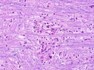 CENTRAL NERVOUS SYSTEM PATHOGENESIS AND PATHOLOGY | PPTX