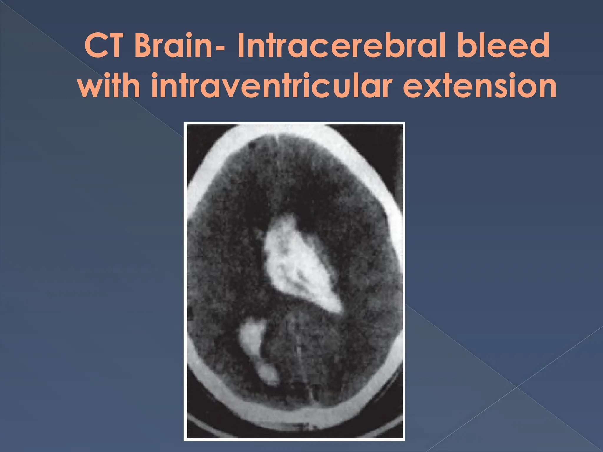 CNS.pptx stroke clinical assessment and evaluation | PPTX