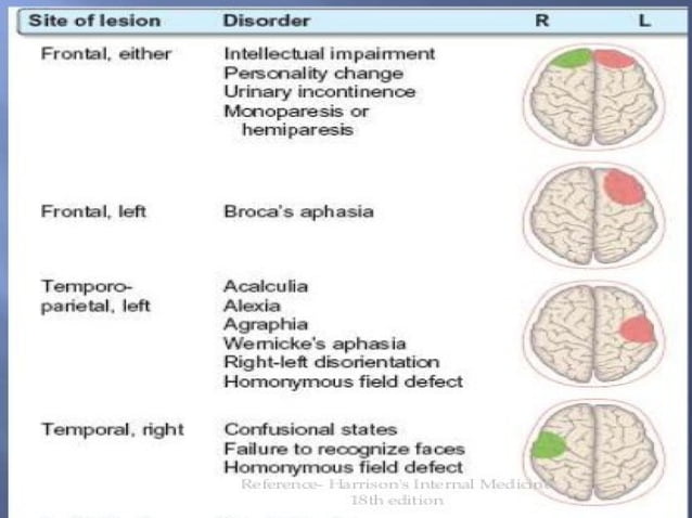 CNS.pptx stroke clinical assessment and evaluation | PPTX | Heart and ...