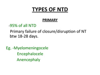Neural tube defects and Craniosynostosis | PPT