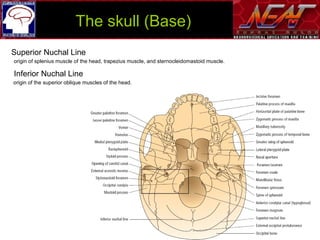 Applied Surgical Anatomy of the Brain and Spinal Cord | PPT