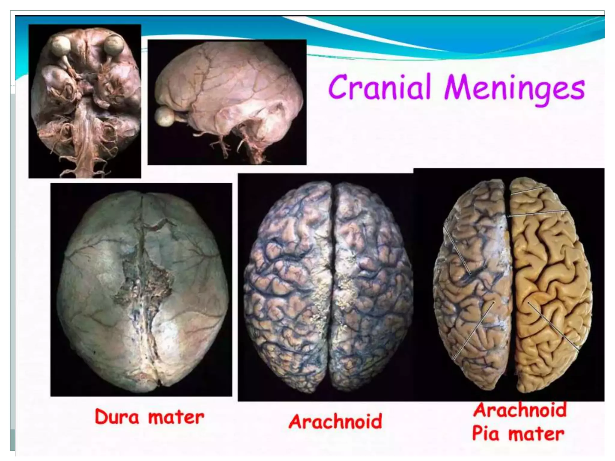 Basic Anatomy CNS | PPTX