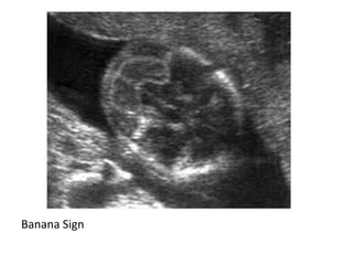 Diagnostic Imaging of Congenital Central Nervous System Diseases | PPT