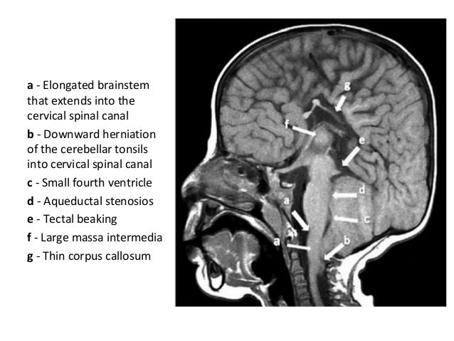 Diagnostic Imaging of Congenital Central Nervous System Diseases