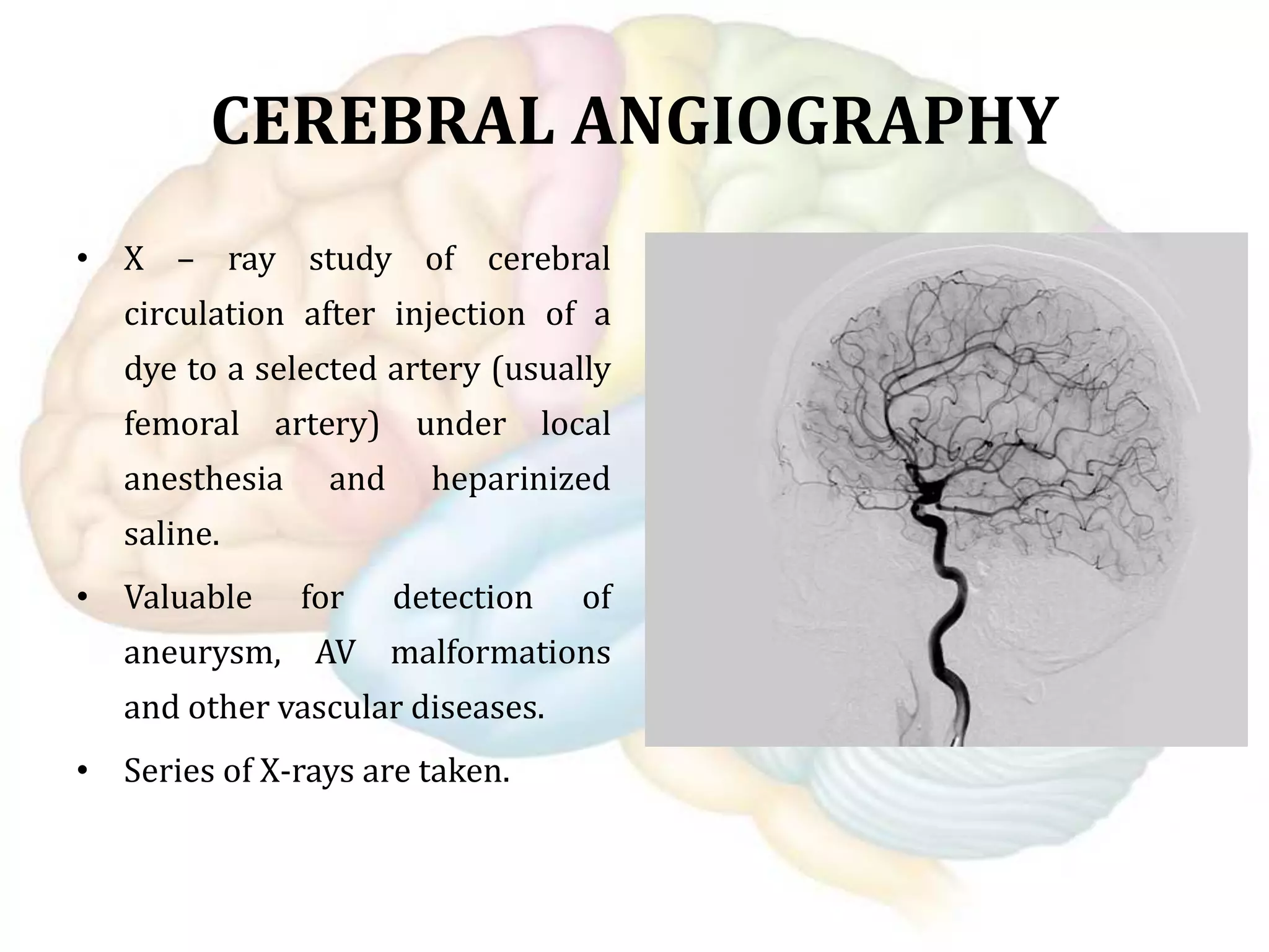 CNS DIAGNOSTIC TESTS | PPTX