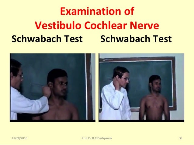Clinical Examination of Nervous System - PPT