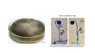 Central Nervous System Fungal Infection | PPTX