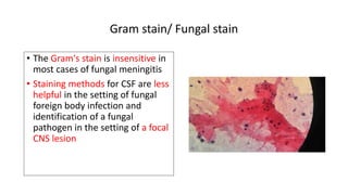 Central Nervous System Fungal Infection | PPTX