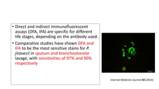 Central Nervous System Fungal Infection | PPTX