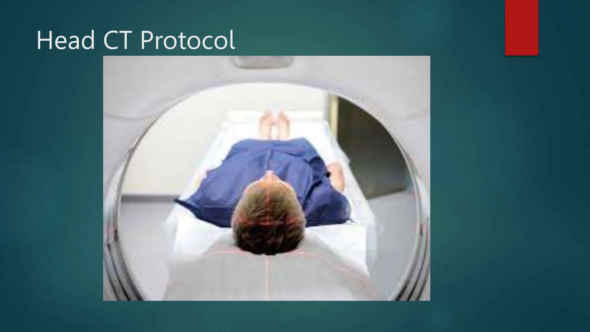 CNS IMAGING.pptx hbcvgvscbsvfxdsgvhjdvbjhfv | PPTX