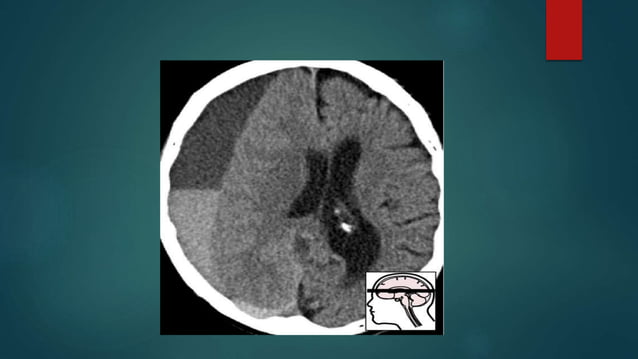CNS IMAGING.pptx hbcvgvscbsvfxdsgvhjdvbjhfv | PPT