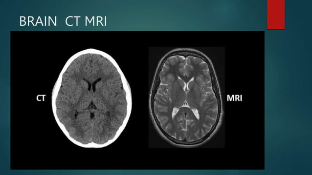 CNS IMAGING.pptx hbcvgvscbsvfxdsgvhjdvbjhfv | PPT