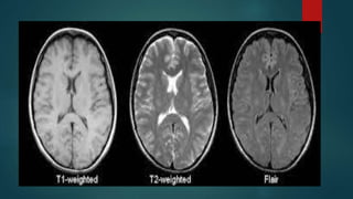 CNS IMAGING.pptx hbcvgvscbsvfxdsgvhjdvbjhfv | PPT