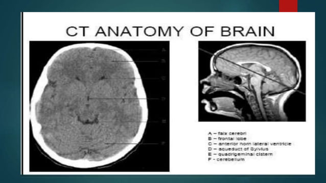 CNS IMAGING.pptx hbcvgvscbsvfxdsgvhjdvbjhfv | PPT