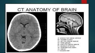 CNS IMAGING.pptx hbcvgvscbsvfxdsgvhjdvbjhfv | PPT