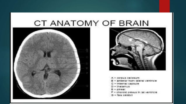 CNS IMAGING.pptx hbcvgvscbsvfxdsgvhjdvbjhfv | PPT