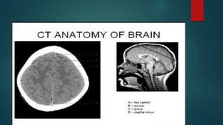 CNS IMAGING.pptx hbcvgvscbsvfxdsgvhjdvbjhfv | PPT