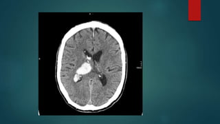 CNS IMAGING.pptx hbcvgvscbsvfxdsgvhjdvbjhfv | PPT