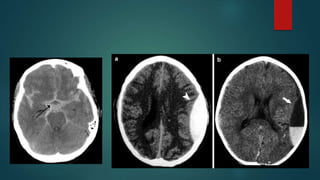 CNS IMAGING.pptx hbcvgvscbsvfxdsgvhjdvbjhfv | PPT