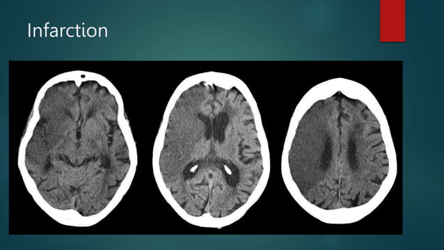 CNS IMAGING.pptx hbcvgvscbsvfxdsgvhjdvbjhfv | PPT